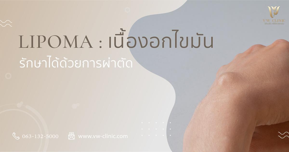 Lipoma เนื้องอกไขมัน รักษาได้โดยการผ่าตัด