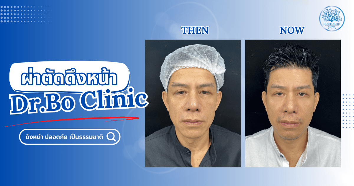 ผ่าตัดดึงหน้าที่ Dr.Bo Clinic เชียงใหม่ – บริการปลอดภัยเพื่อผลลัพธ์ที่ ...