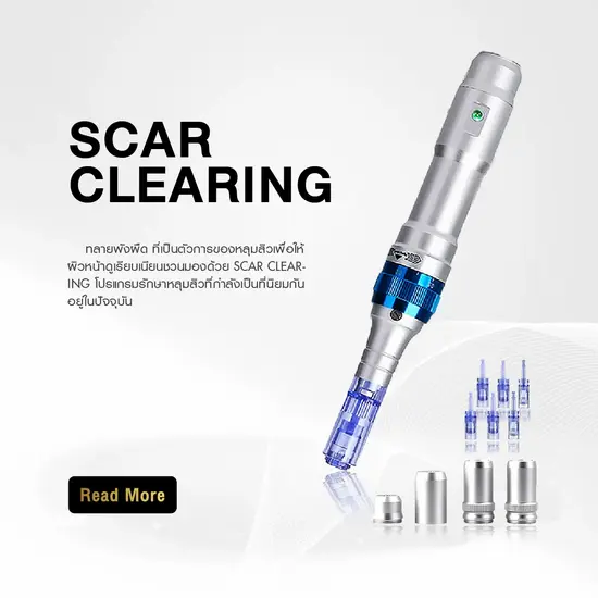 กลบหลุมสิวด้วย Scar Clear โปรแกรมตัดพังผืดสาเหตุของหลุมสิวเผยผิวเรียบเนียน